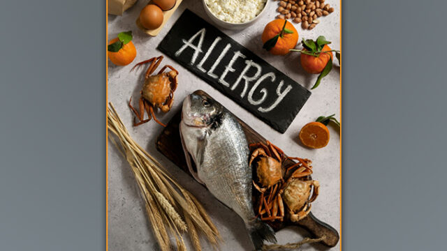 Navigating Food Allergies & Dietary Needs at Camp | Birmingham Parent